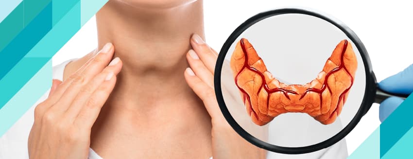 What Is Hyperthyroidism