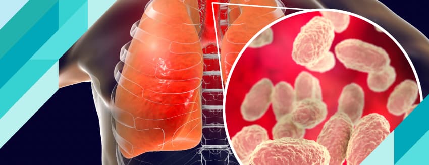 Boğmaca Hastalığı Nedir? Belirtileri Nelerdir? | NPİSTANBUL