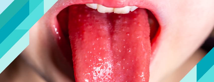 What Is Scarlet Fever