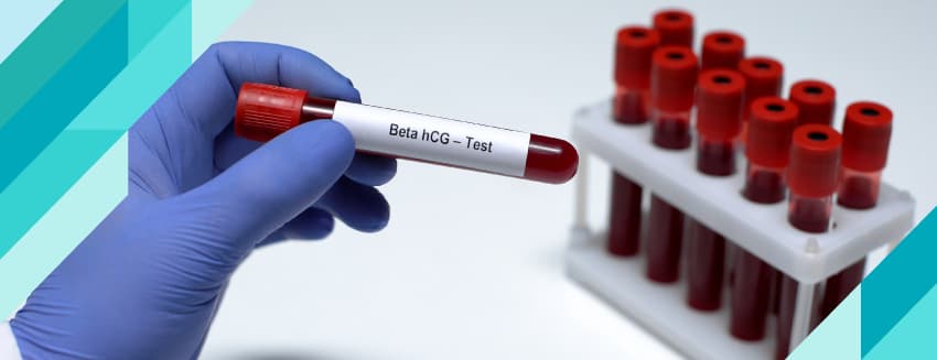 Beta HCG Nedir? Gebelik Haftasına Göre HCG Değerleri Nedir?